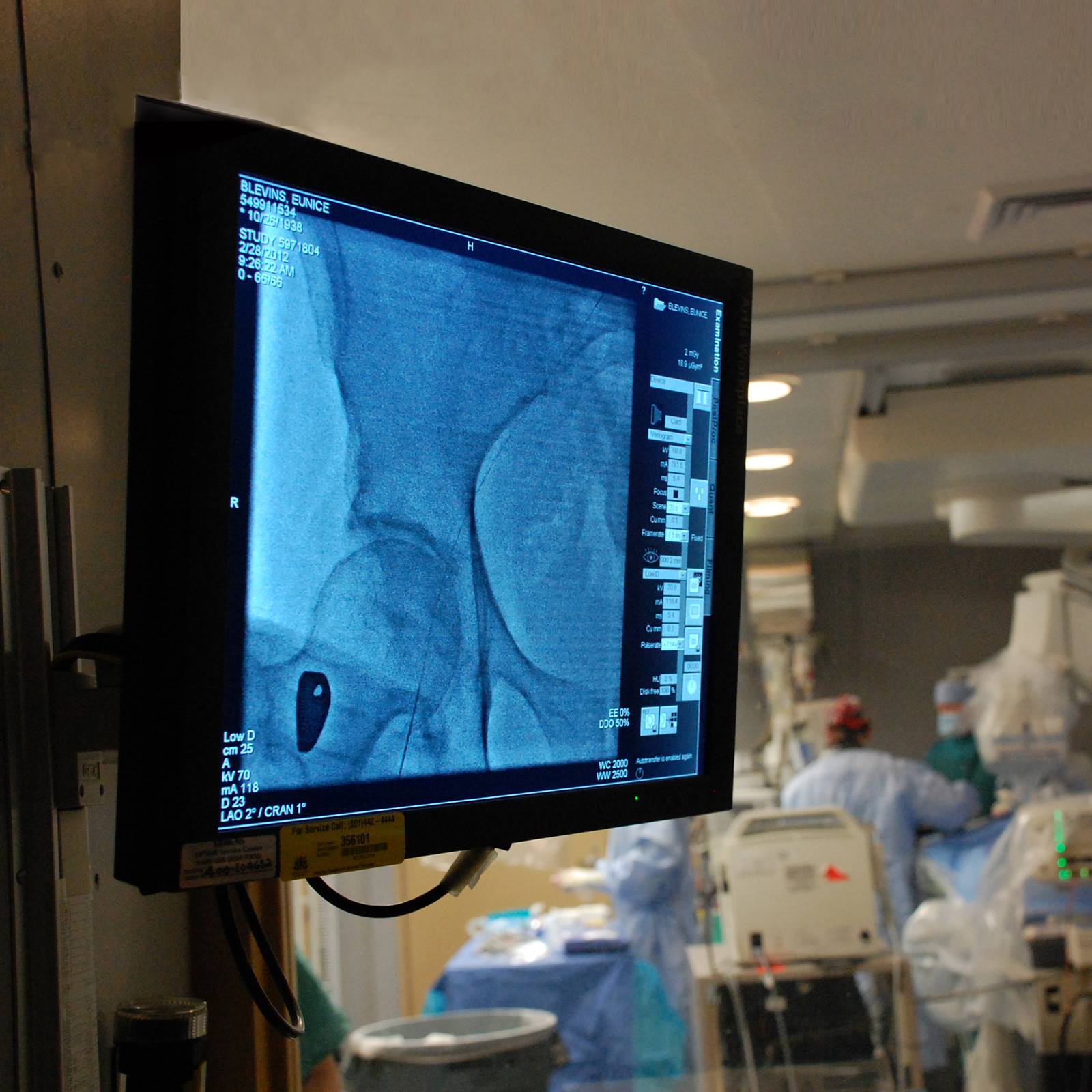Detection and Diagnosis, Spontaneous Coronary Artery Dissection (SCAD ...