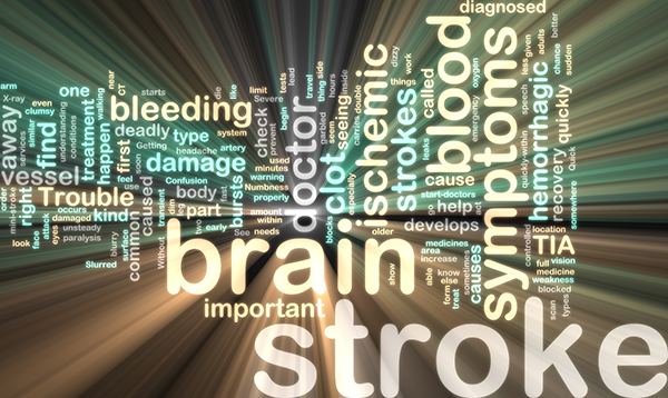 A Stroke Can Strike Anyone at Any Age. Here's the Warning Signs and 4 ...
